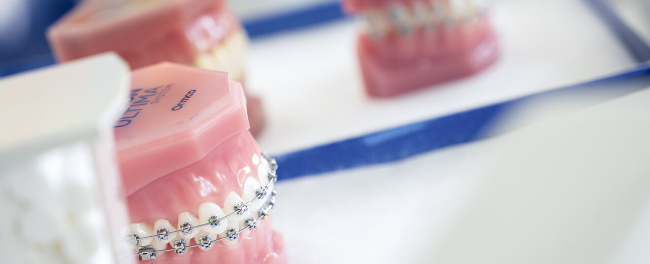 Damon® System - Damon® Brackets - Kieferorthopädische Praxis Kyriasi ...