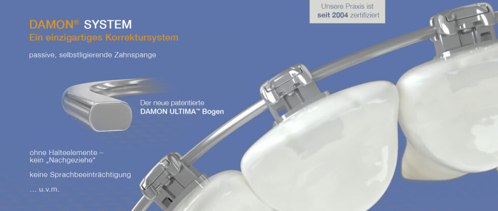 Damon® System - Damon® Brackets - Kieferorthopädische Praxis Kyriasi ...